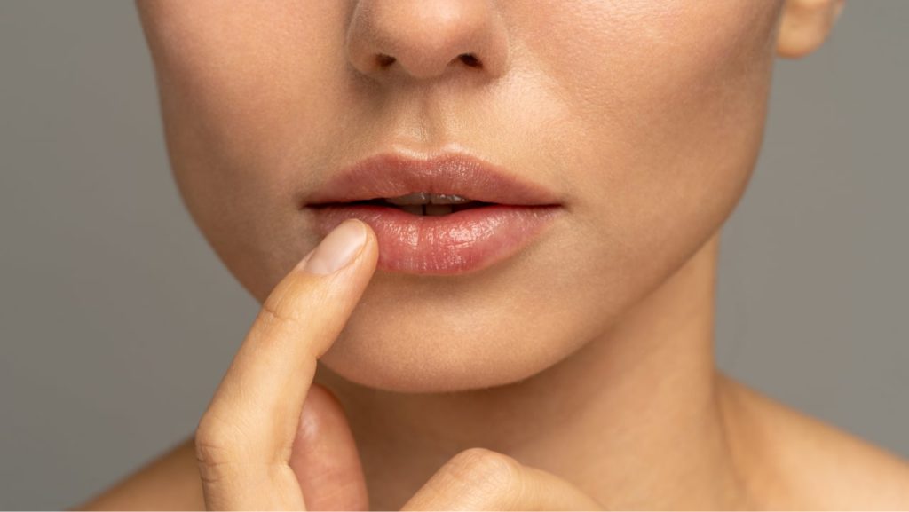 The Complete Guide To Lip Lifts | Discover Radiance